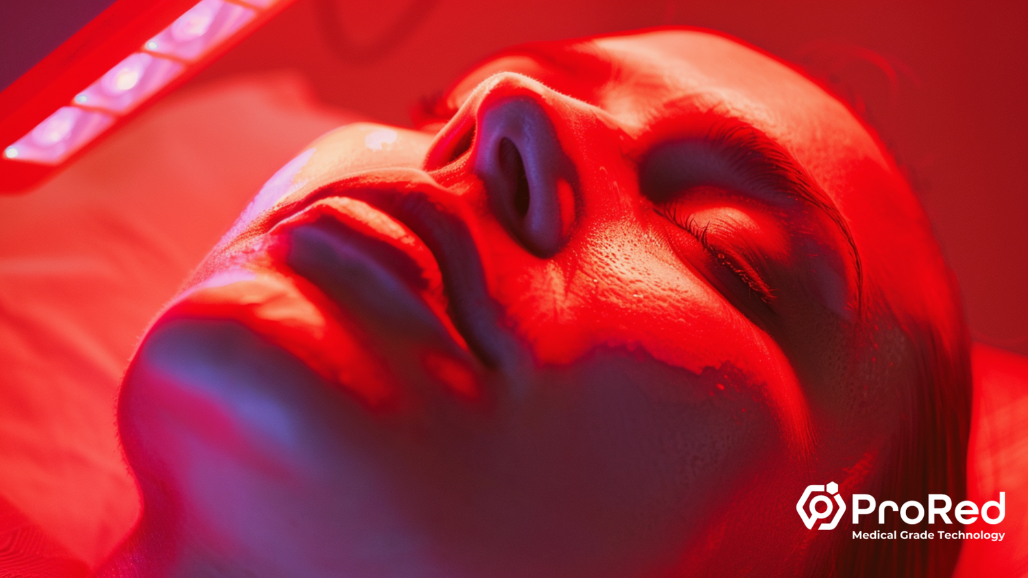 The Role of ProRed Therapy in Post-Traumatic Edema and Bone Fracture R